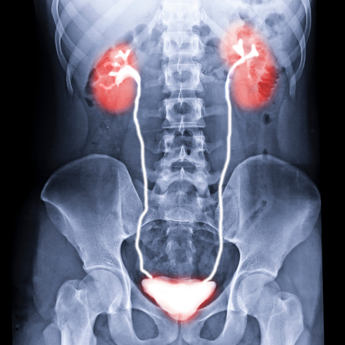 Gyakori vizelési inger - Ilyenkor forduljon orvoshoz! - Urológiai Központ